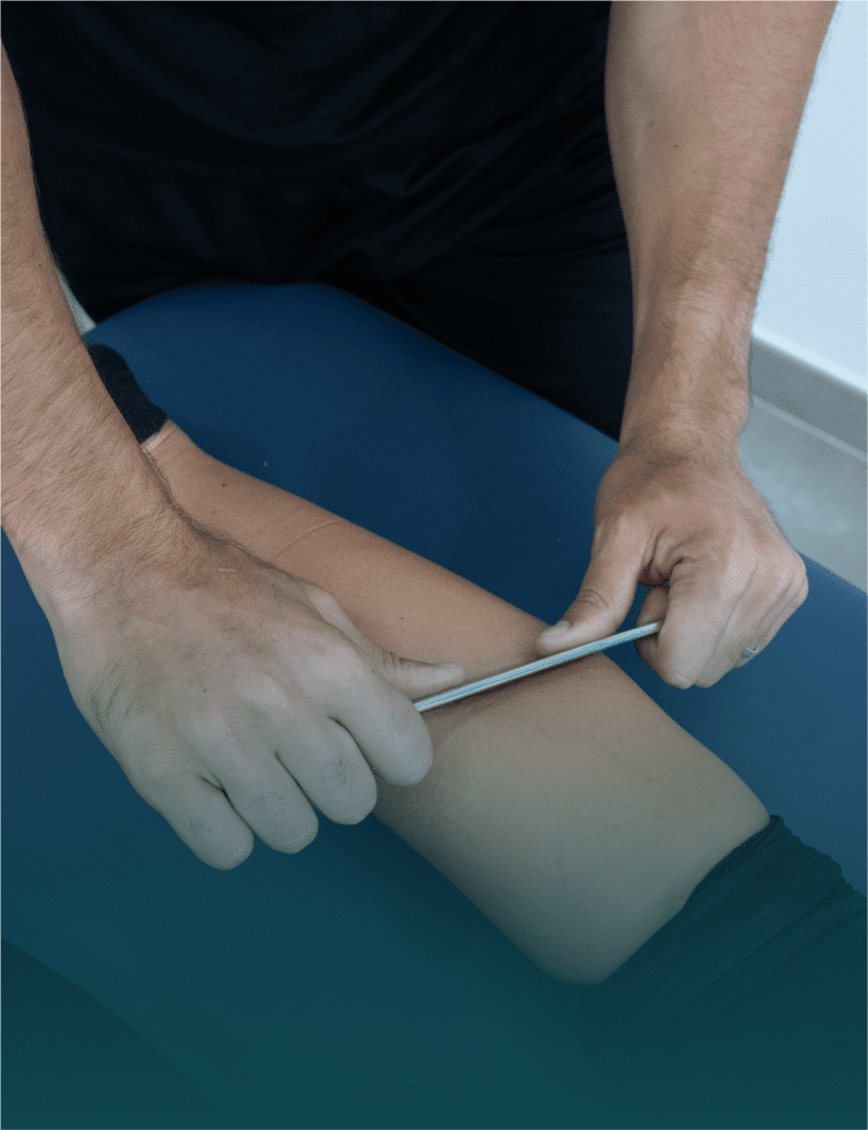 IASTM | Vitruvian Italian Physiotherapy Center
